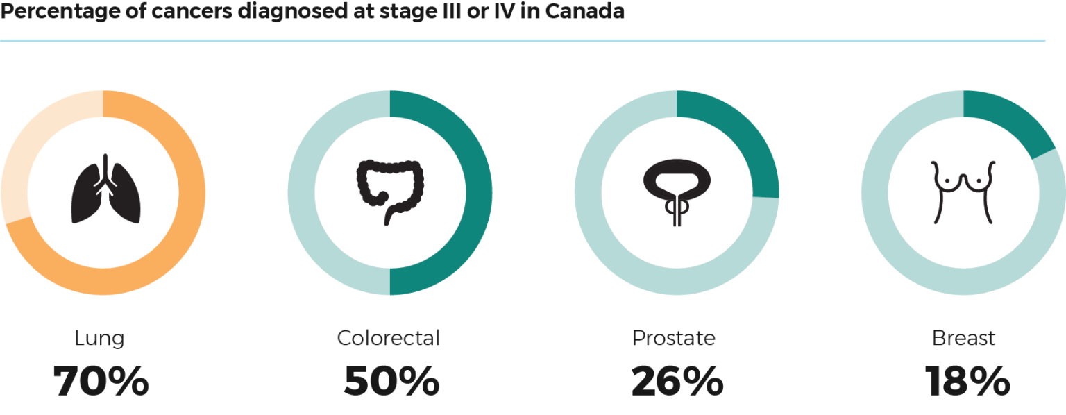 Diagnosis and treatment – Canadian Partnership Against Cancer